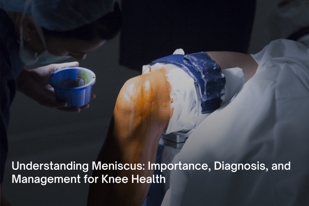 Understanding Meniscus: Importance, Diagnosis, and Management for Knee ...